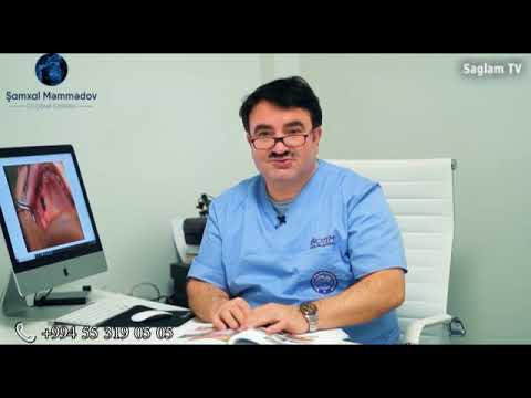 DENTAL İMPANTOLOGİYA. ÜZ-ÇƏNƏ CƏRRAHI ŞAMXAL MƏMMƏDOV. SAMXAL MEMMEDOV. SAGLAM TV. DİŞ ESKİKLİYİ