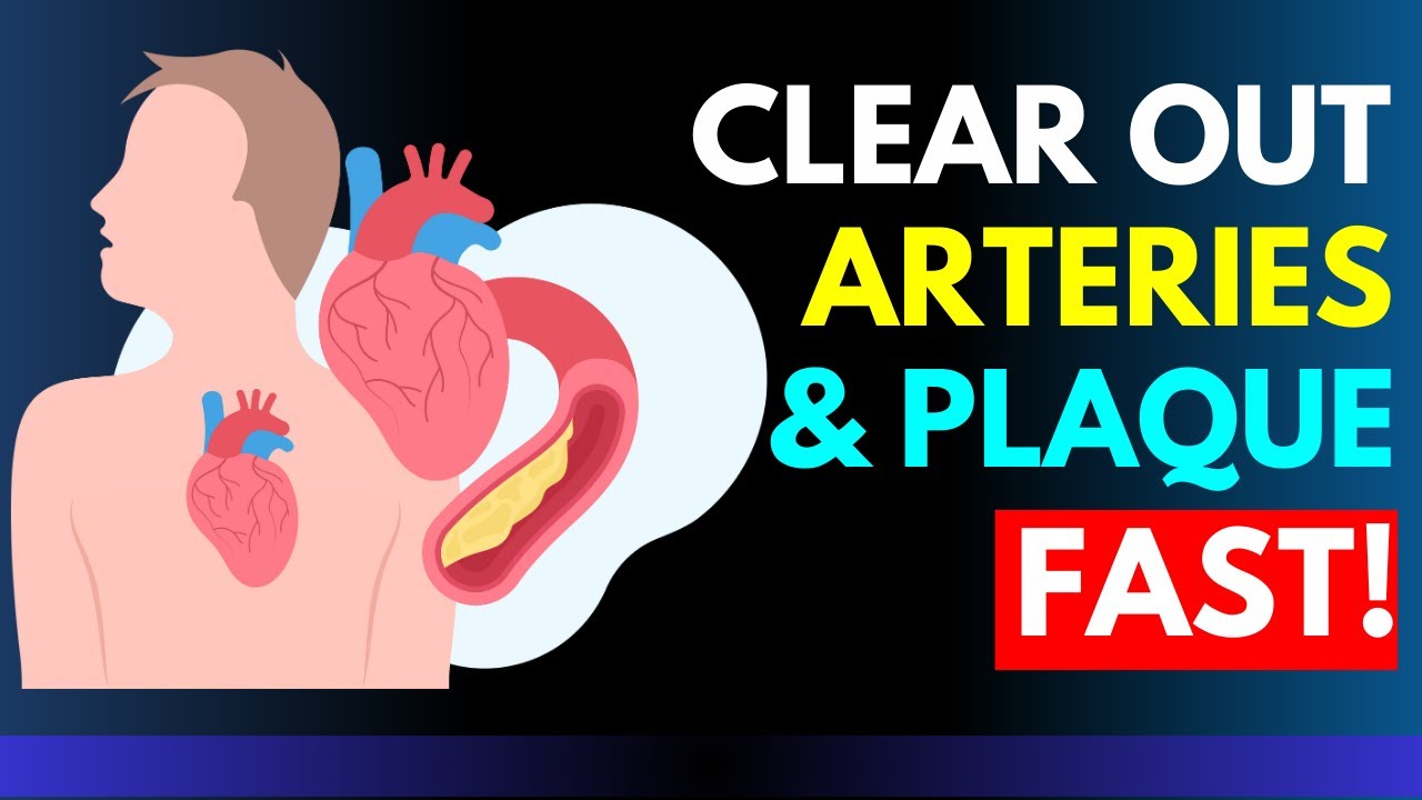 Clean Arteries: How to Remove Plaque Naturally. - YouTube