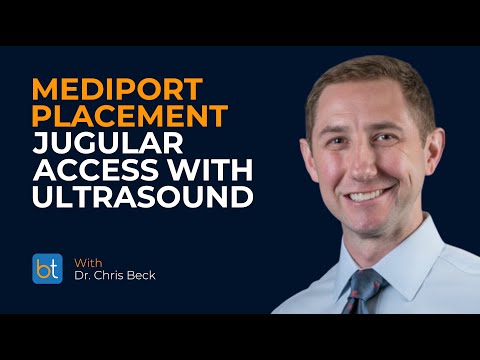 Mediport Placement Jugular Access With Ultrasound | BackTable Clips ...