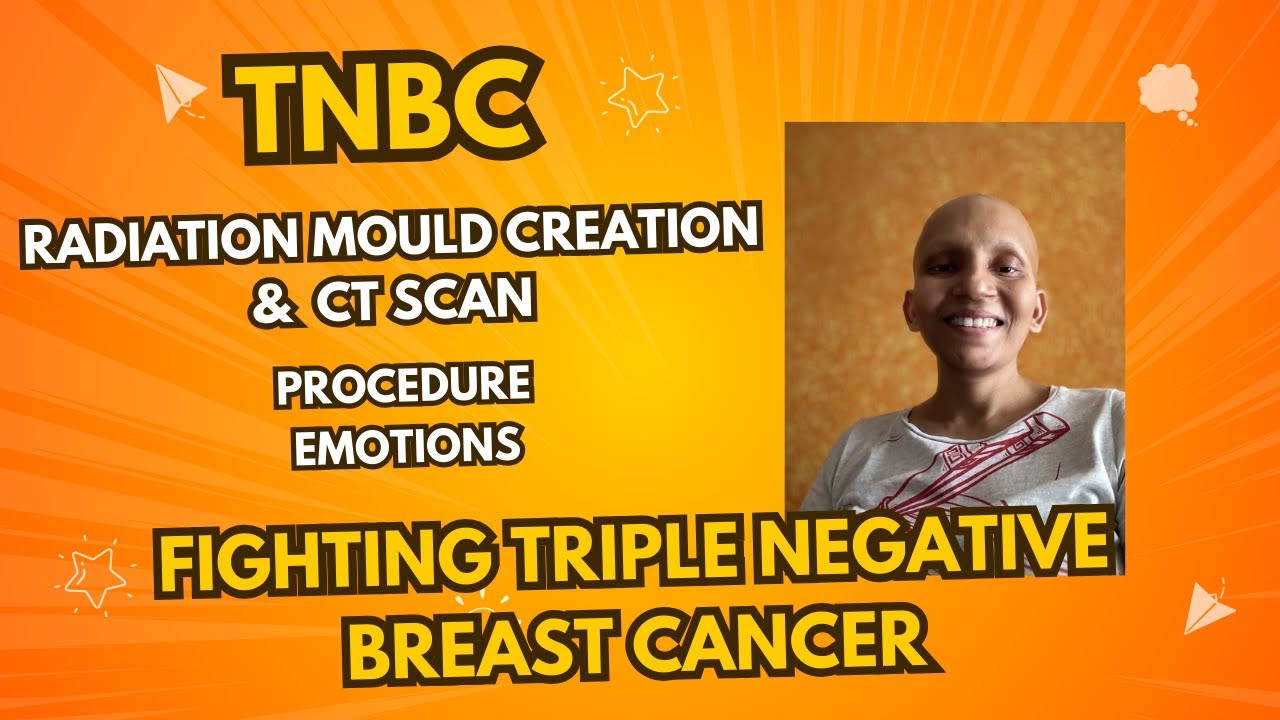 Radiation Mold/Cast Creation| Triple Negative Breast Cancer | TNBC ...