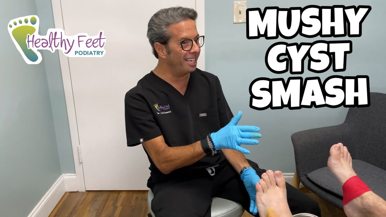 SMASHING AND POKING AN ENORMOUS MUSHY GOOSHY GANGLION CYST! - YouTube