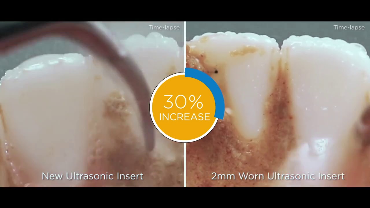 Optimizing insert performance over time | Dentsply Sirona - YouTube