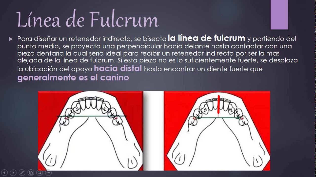 DISEÑO PPR (Primera Parte) - YouTube