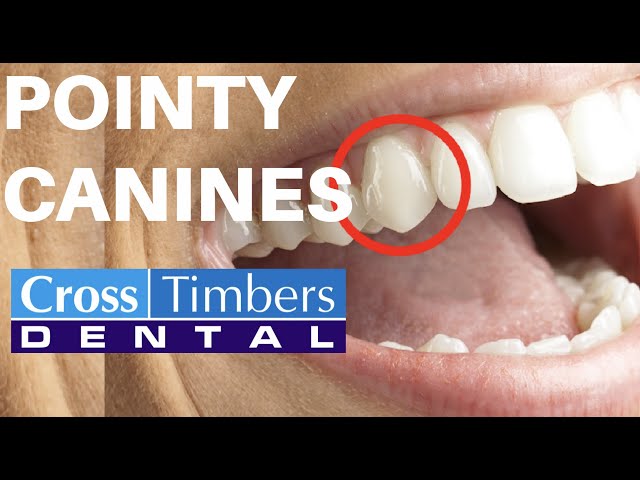 Pointy Canine Teeth