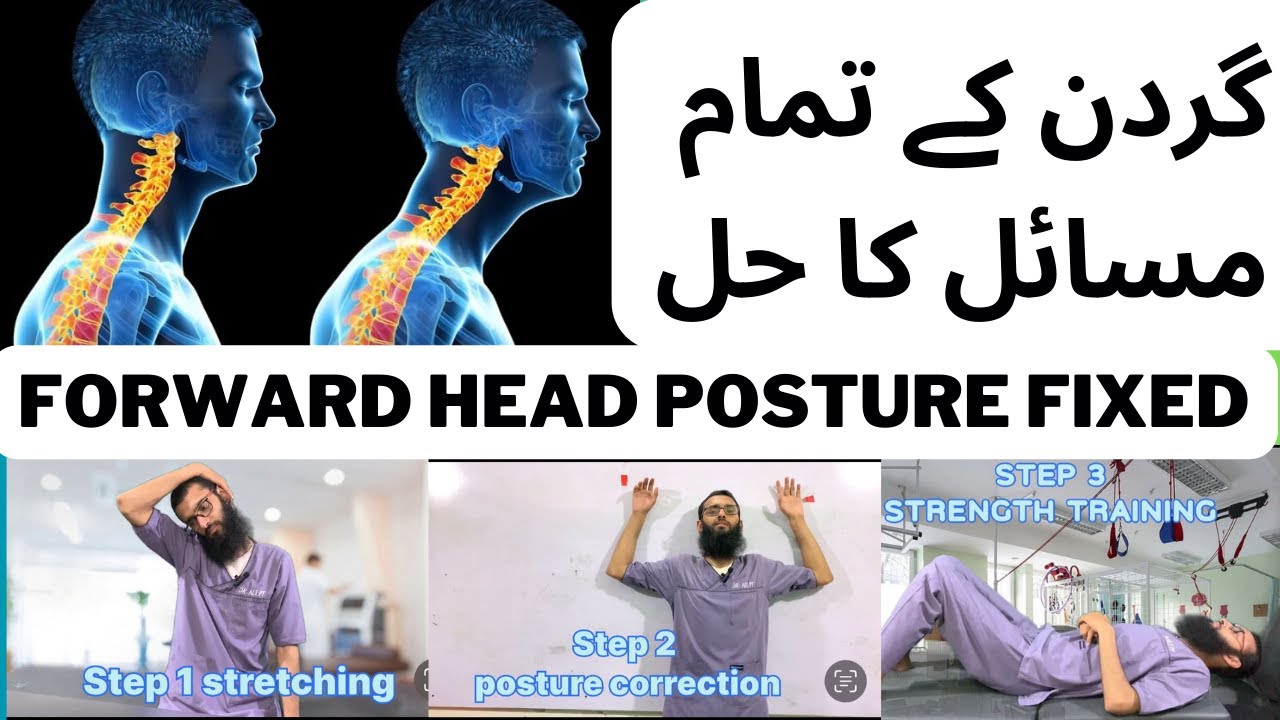 Treatment of Mechanical neck pain and stiffness by manual therapy ...