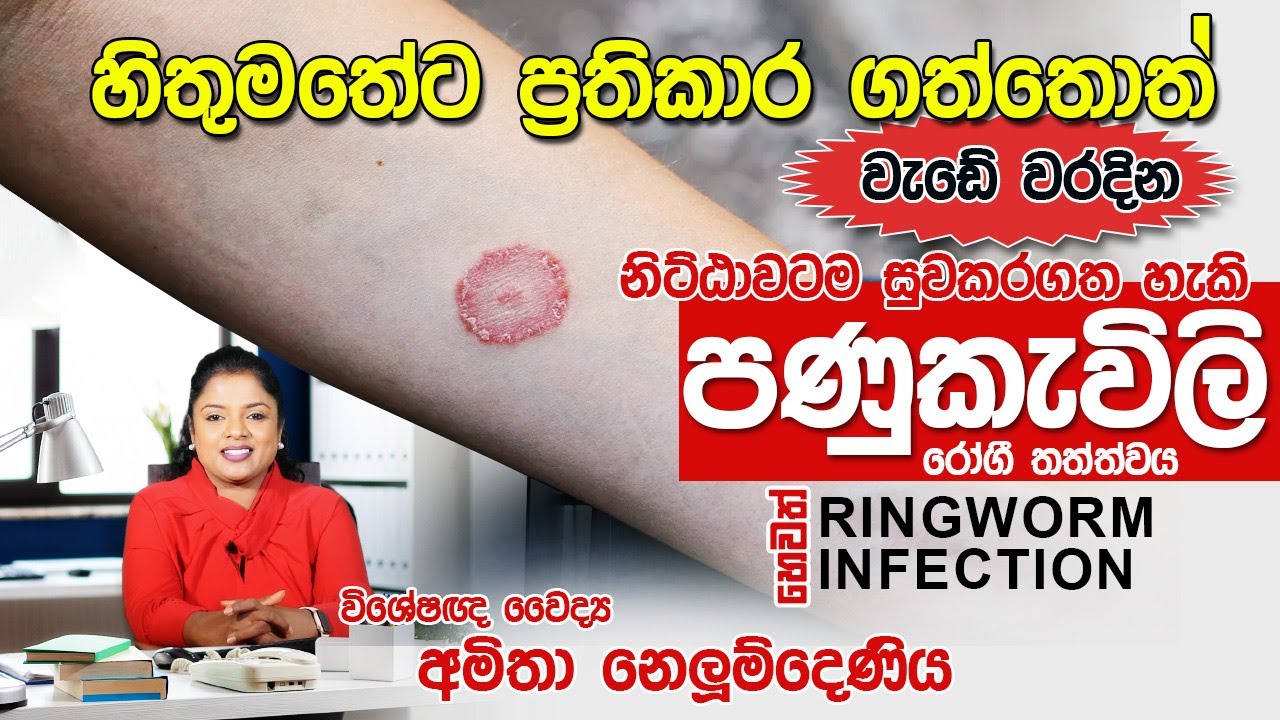 Fungus On Skin Treatment Sinhala