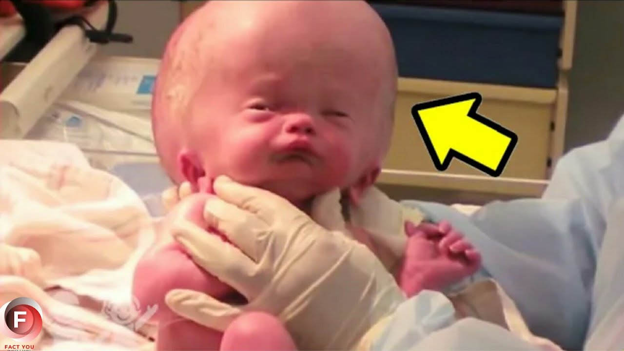 He was born with GIANT HEAD, so his parents decide to do THAT! - YouTube