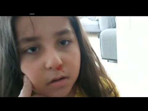 Maşita nin burnunu cafer kanattı