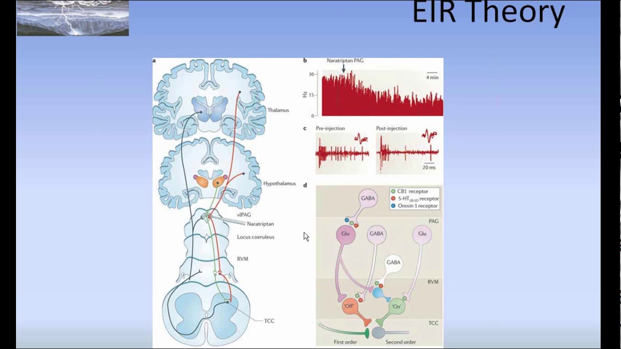 STN Webinar: Paroxysmal Sympathetic Hyperactivity - YouTube