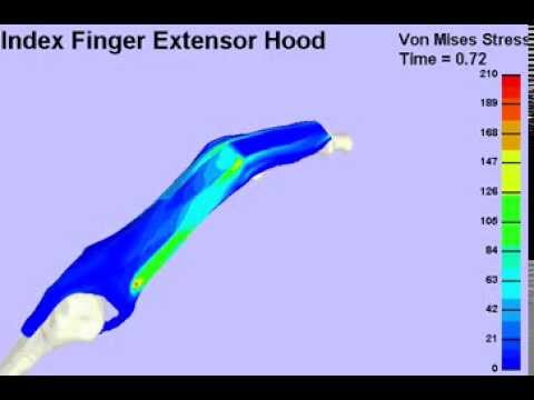 Finger Extensor Hood - YouTube