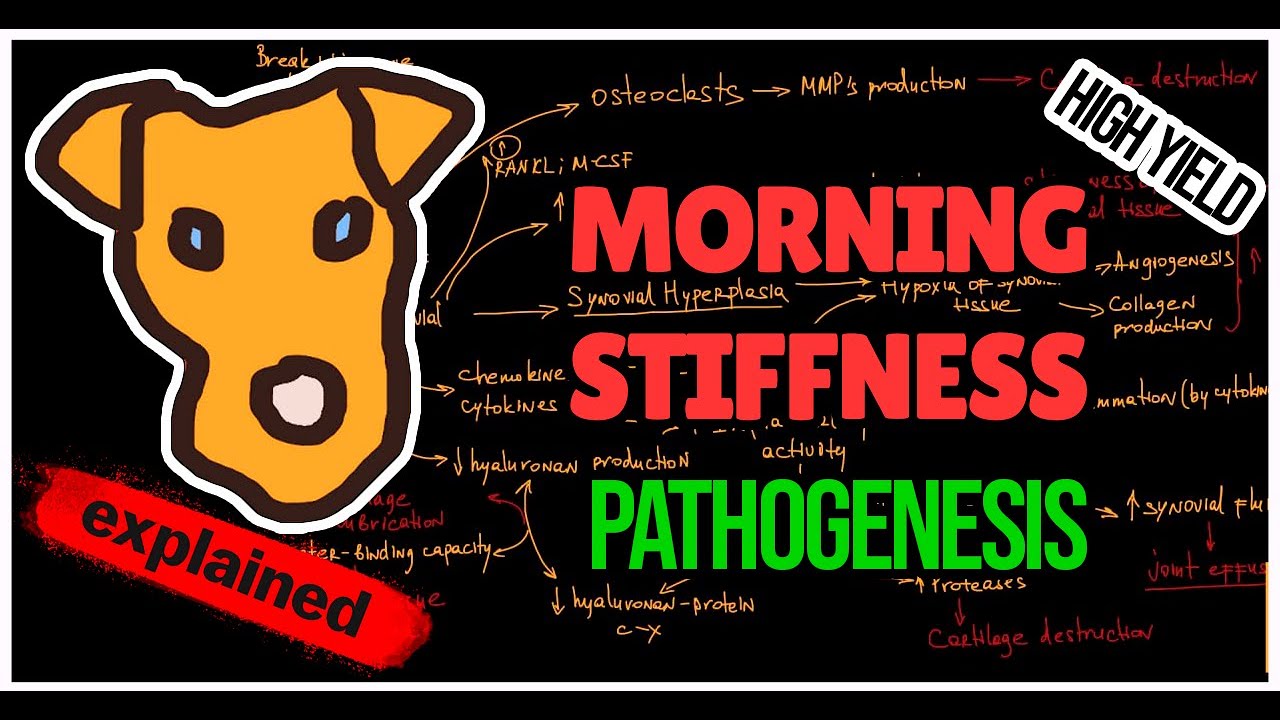 Pathogenesis of Morning Stiffness - YouTube