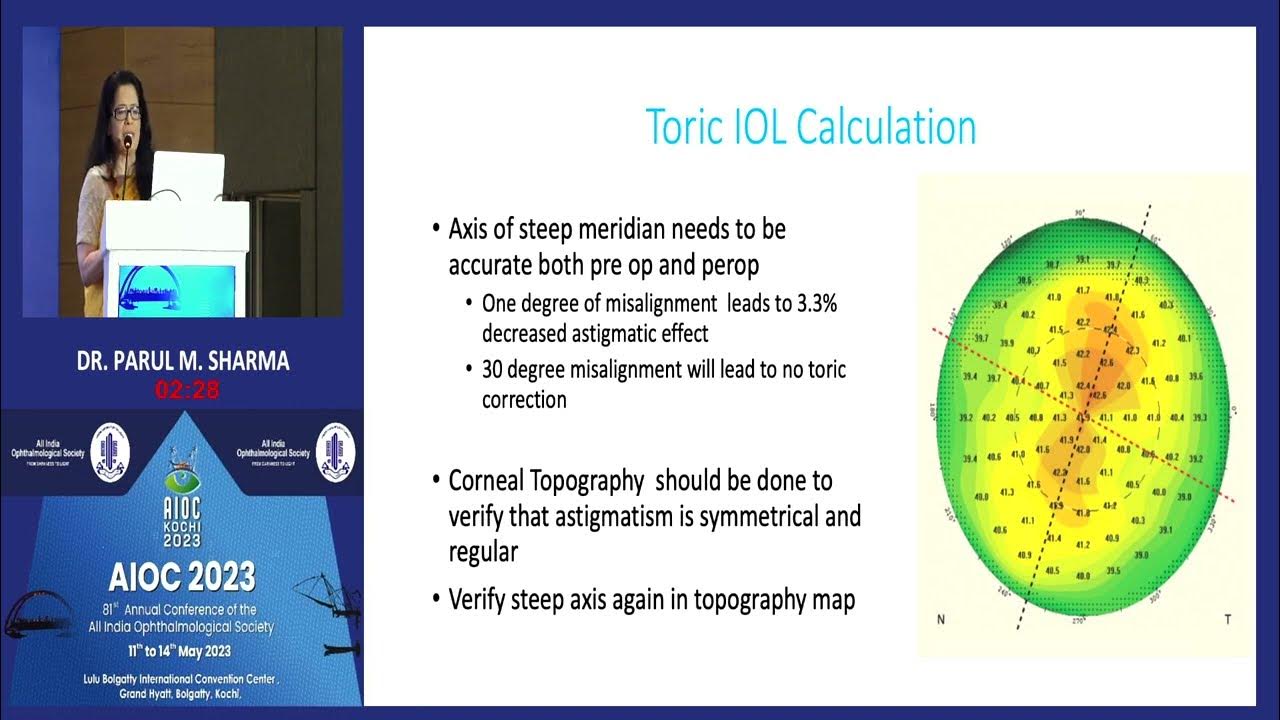 AIOC 2023 GP16 topic Dr Parul Sharma Optimizing Toric IOL accuracy - YouTube