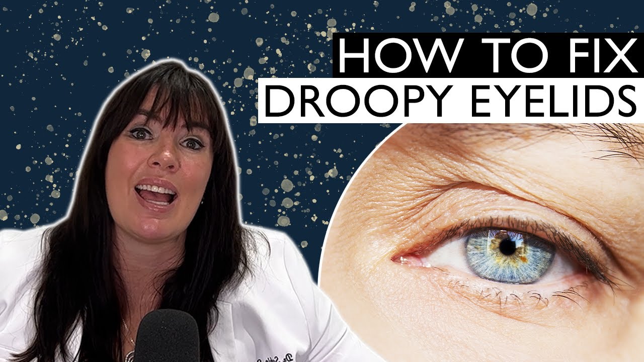 How to Fix Droopy, Sagging Eyelids Non-Surgically - YouTube