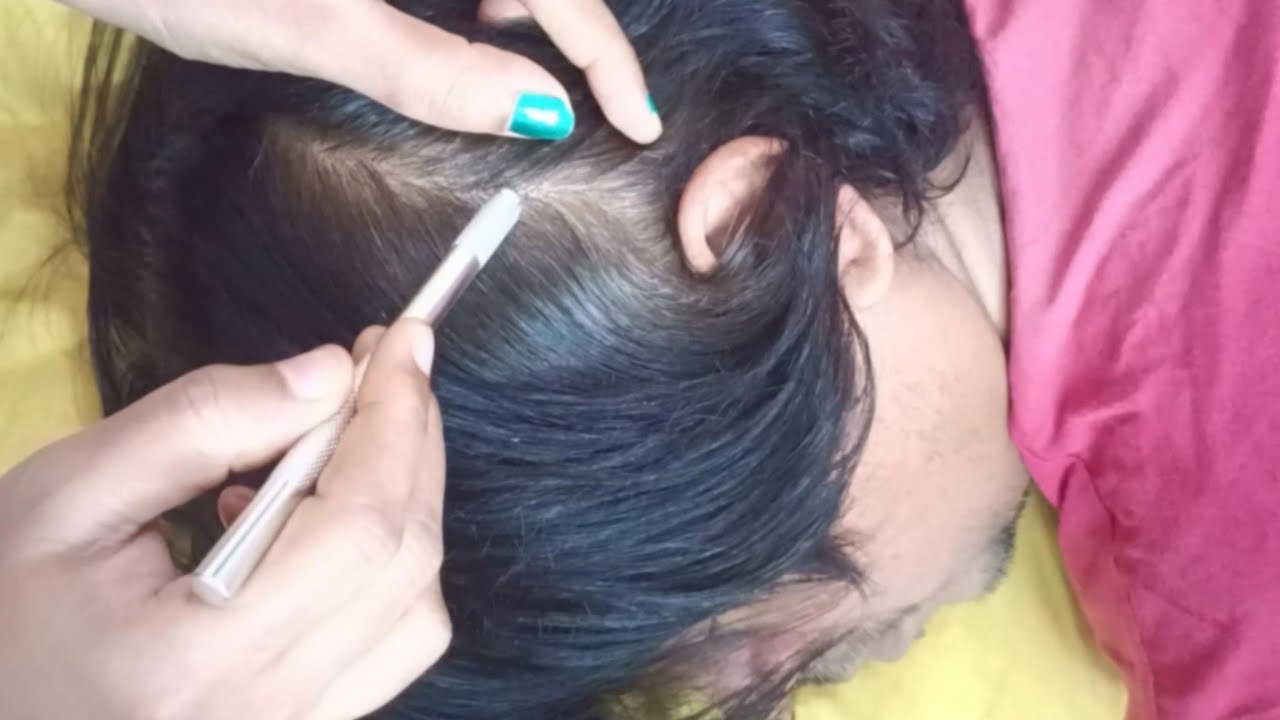 Scalp Check & Hairplay: The Ultimate ASMR Experience - YouTube