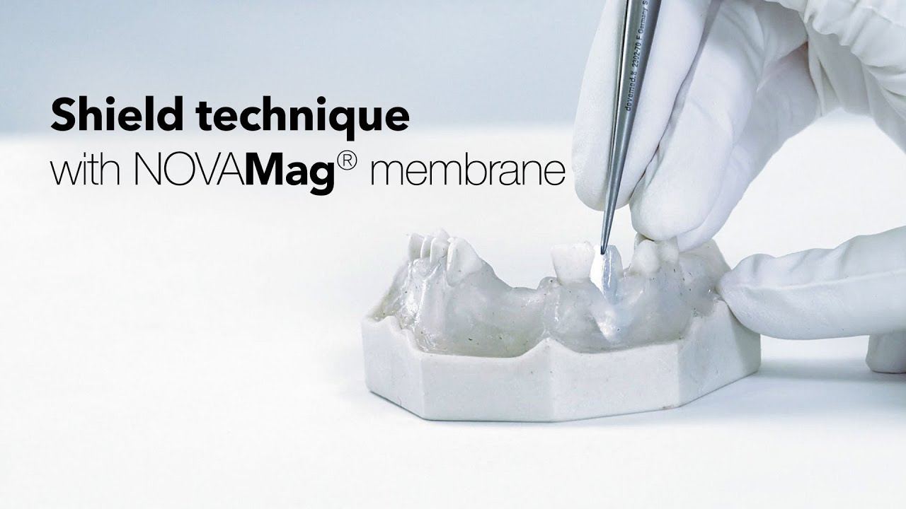 Shield technique with NOVAMag® membrane - YouTube