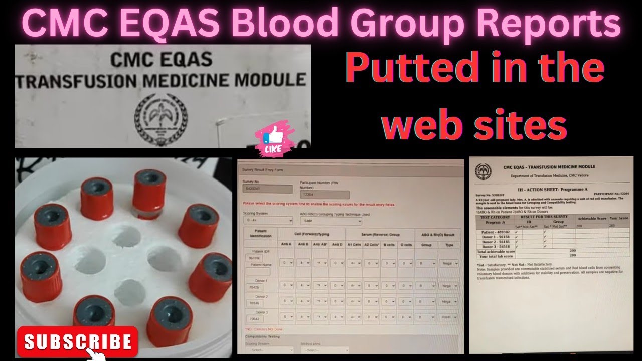 CMC EQAS blood group report | @medicallabtechnologysajal6903 - YouTube