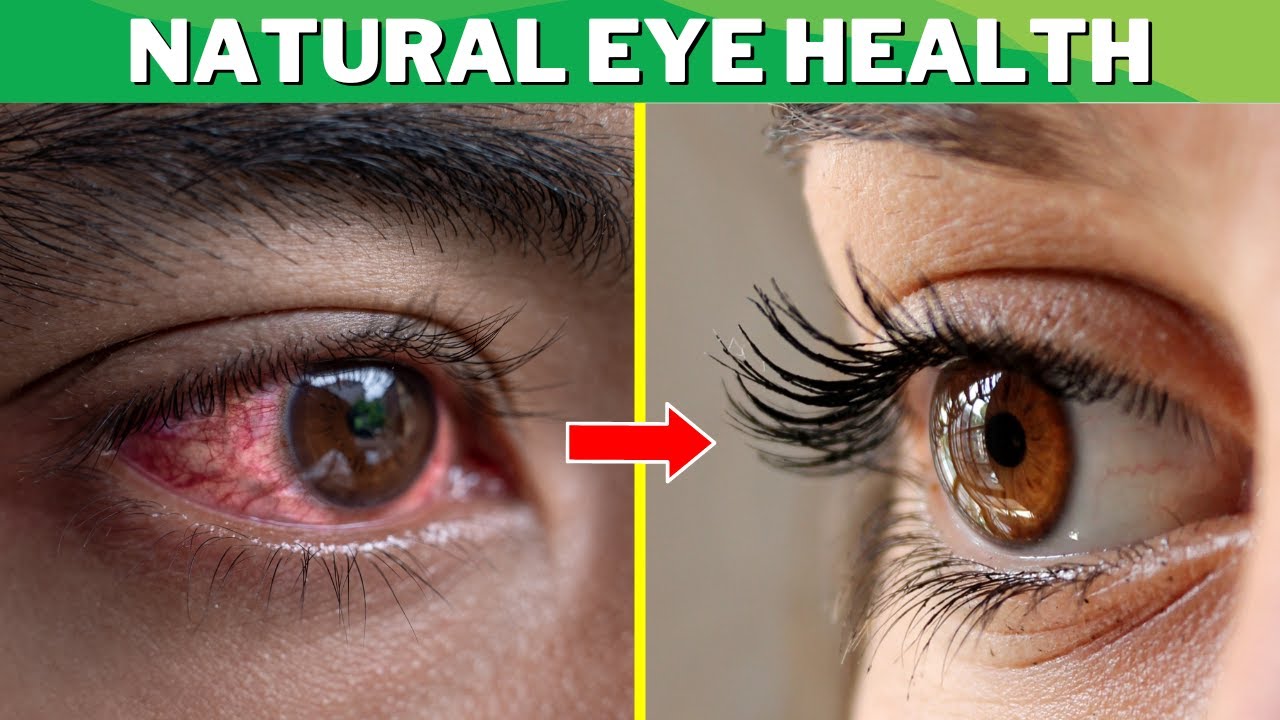 The Secret to Naturally Healthy Eyes 10 Amazing Tips - YouTube