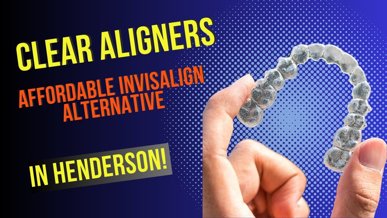 Affordable clear aligners in Summerlin NV (702) 442-0128 Best Summerlin ...