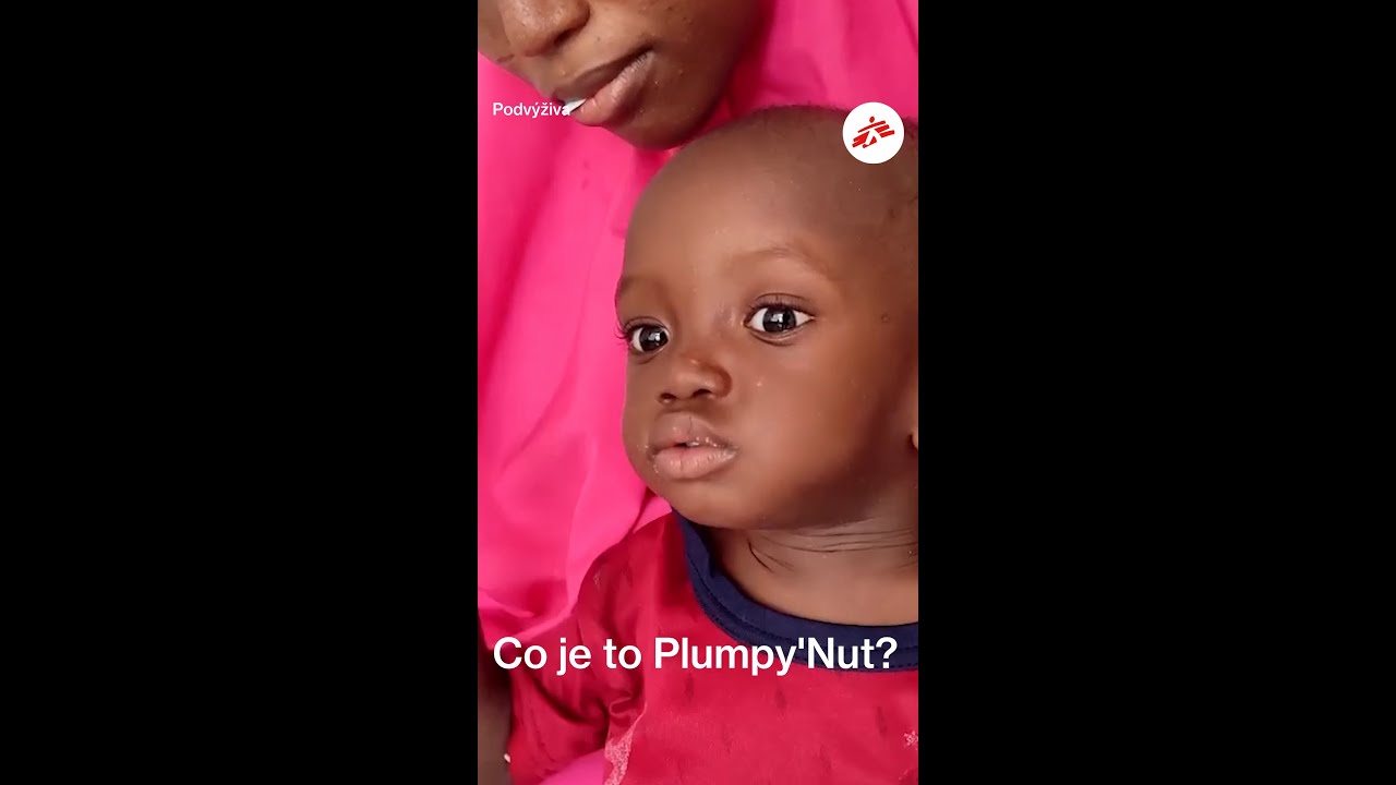 Co je to Plumpy'Nut? - YouTube
