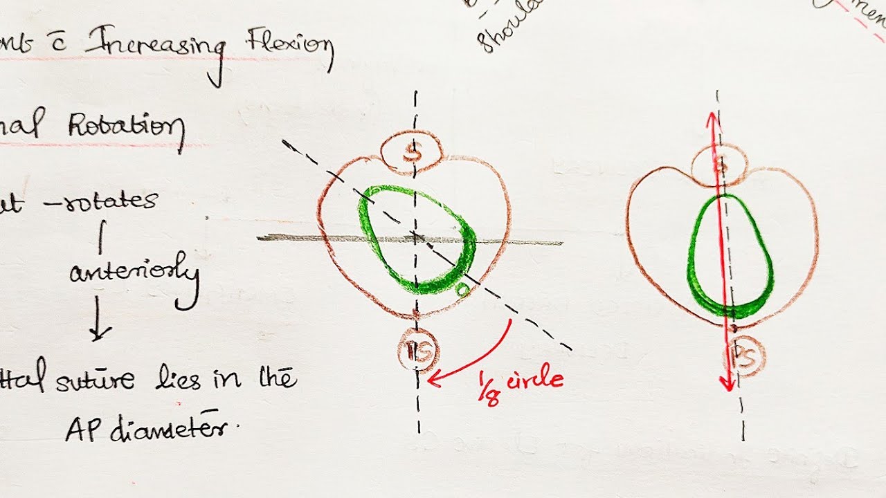 Breech Presentation Part-1, Obstetrics - YouTube