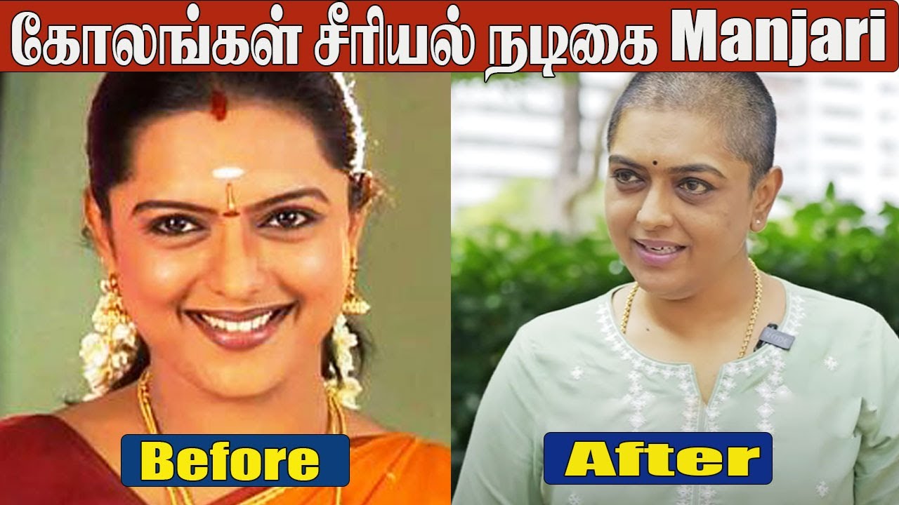 Kolangal Serial Actress Manjari Shocking Transformation | முடியை இழந்த ...