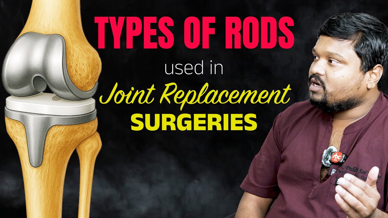 Types of Surgical Rods used in Joint Replacement Surgery | Knee ...
