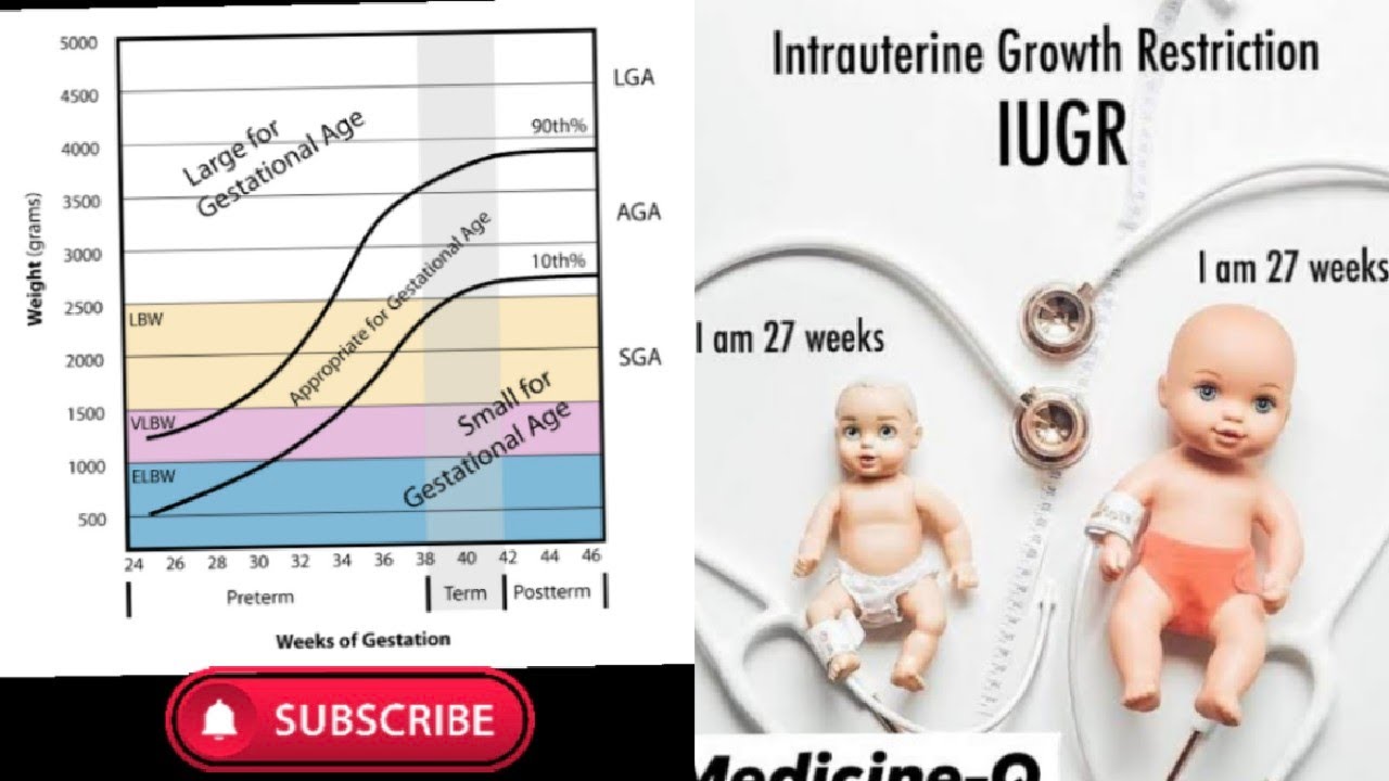 IUGR | phase of growth | Definition | causes | difference between ...