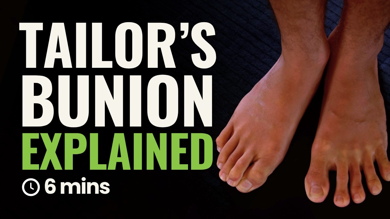 What Is a Tailor’s Bunion? Podiatrist Explains the REAL Causes ...