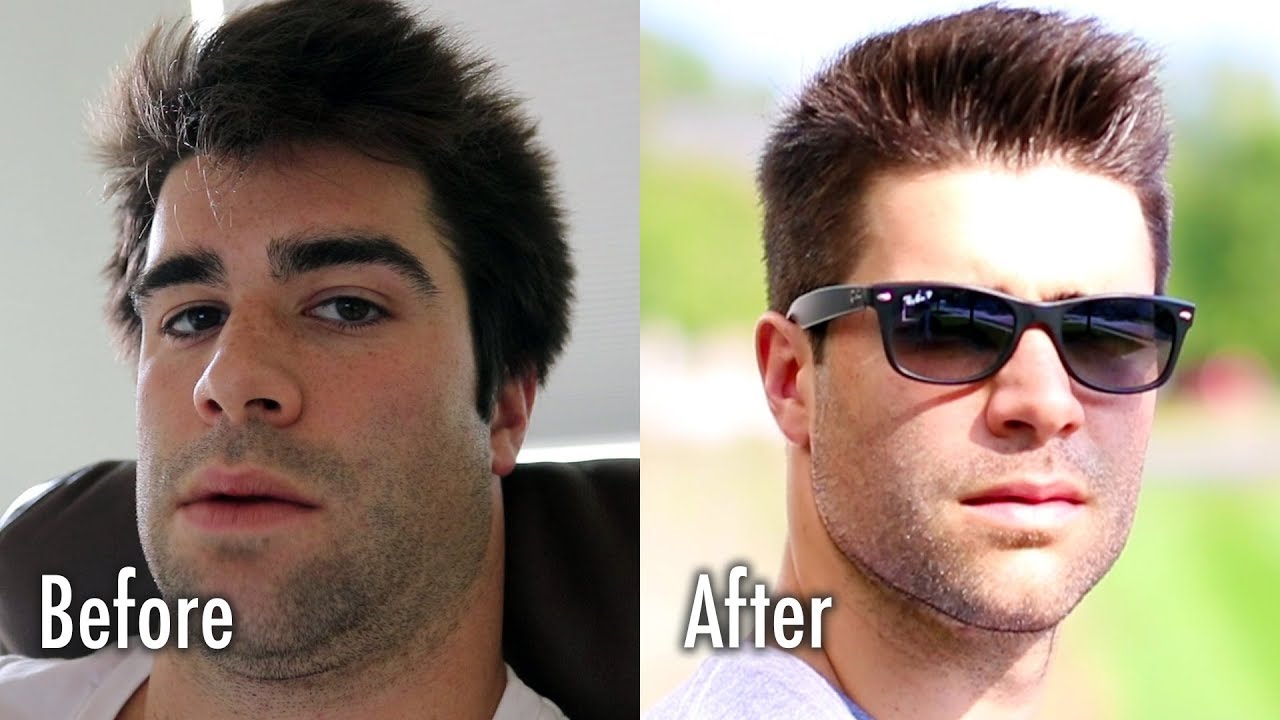 Head Transformation - YouTube