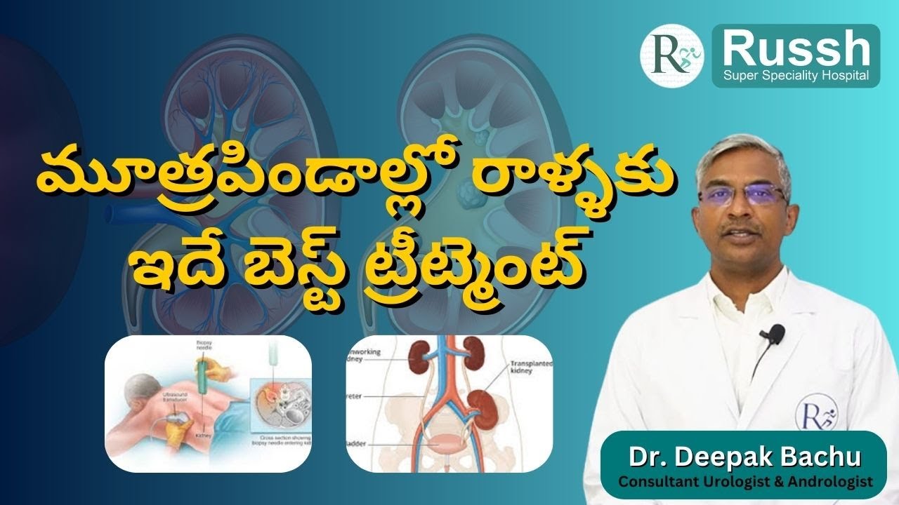 Treament Opions for Kindey Stones in Telugu | Dr Deepak Bachu | Russh Hospital# ...