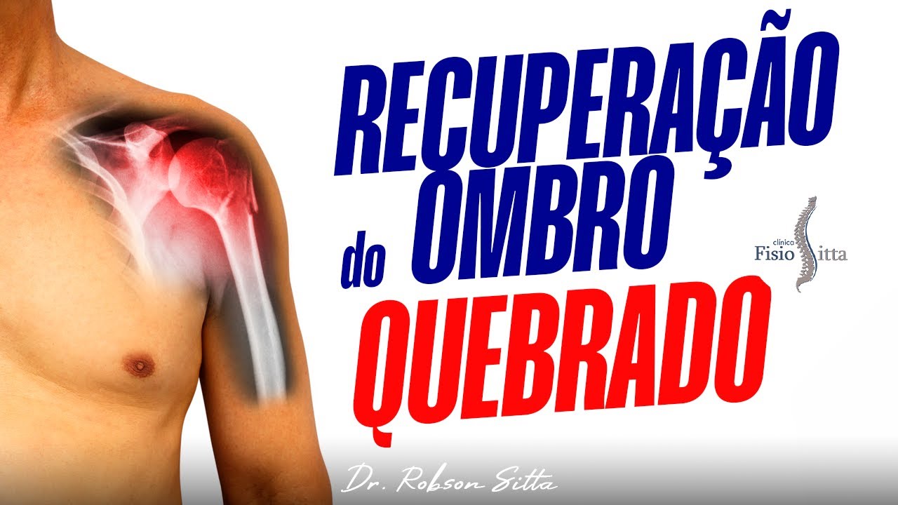 RECUPERAÇÃO do OMBRO QUEBRADO SEM CIRURGIA - Clínica Dr. Robson Sitta ...