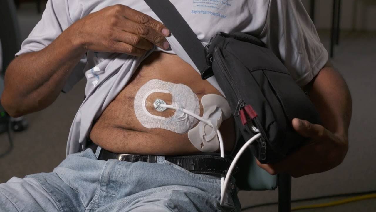 VIDEO: New exercise advice for people with ICD’s - YouTube