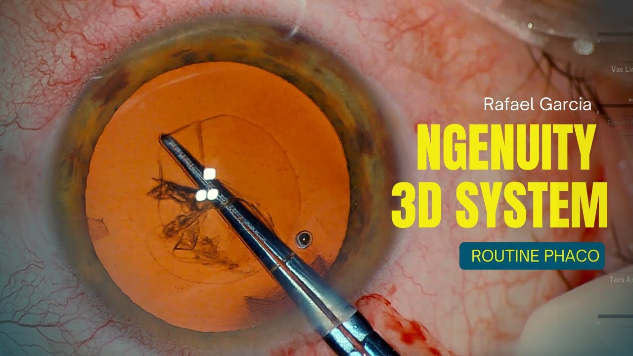Ngenuity 3D Visualization System - YouTube