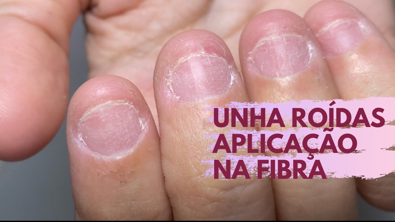 UNHAS ROIDAS | APLICAÇÃO NA FIBRA | ESPAÇO ELLEN CRISTINA | UNHA DE ...
