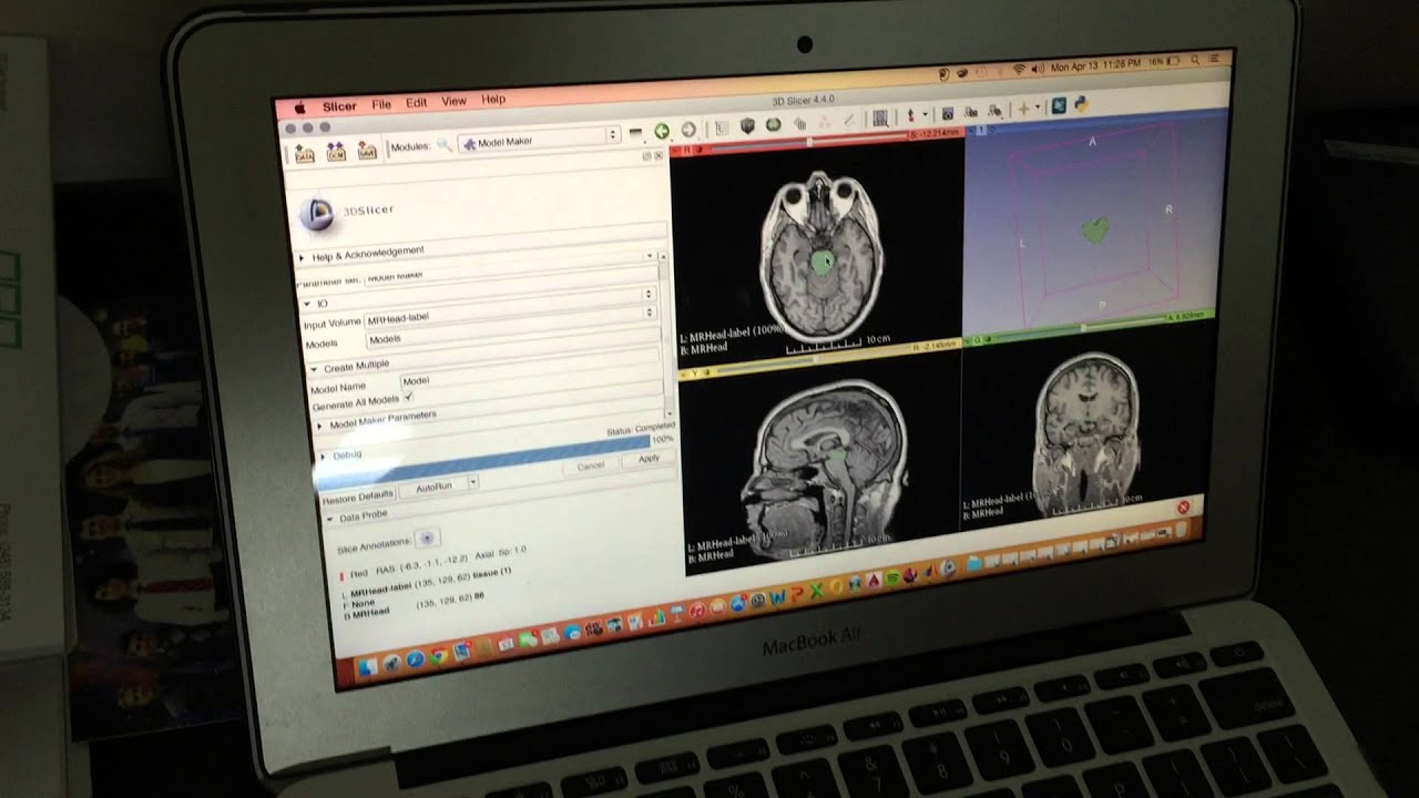 3D-Slicer and Image registration - YouTube
