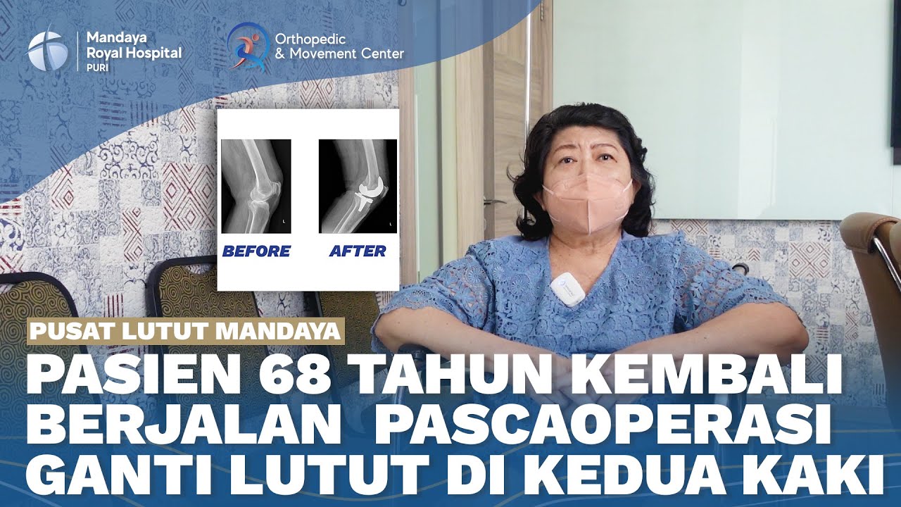 Pengalaman Pasien Pengapuran Lutut Melakukan Operasi Ganti Lutut di ...
