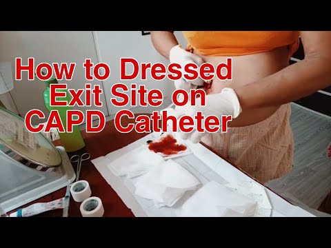 How To Dressed Exit Site on CAPD Catheter // Personal Experienced on My ...