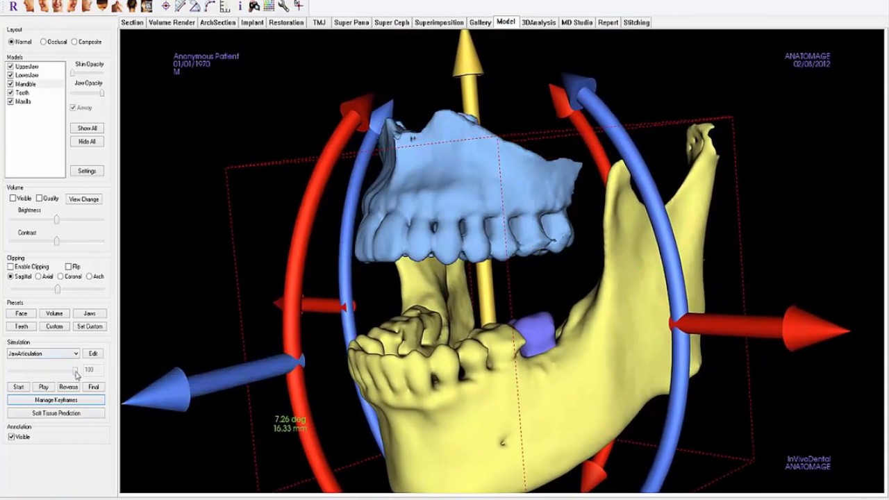 Invivo™ 5.4.5 Training Series: Introduction to Medical Design Studio ...