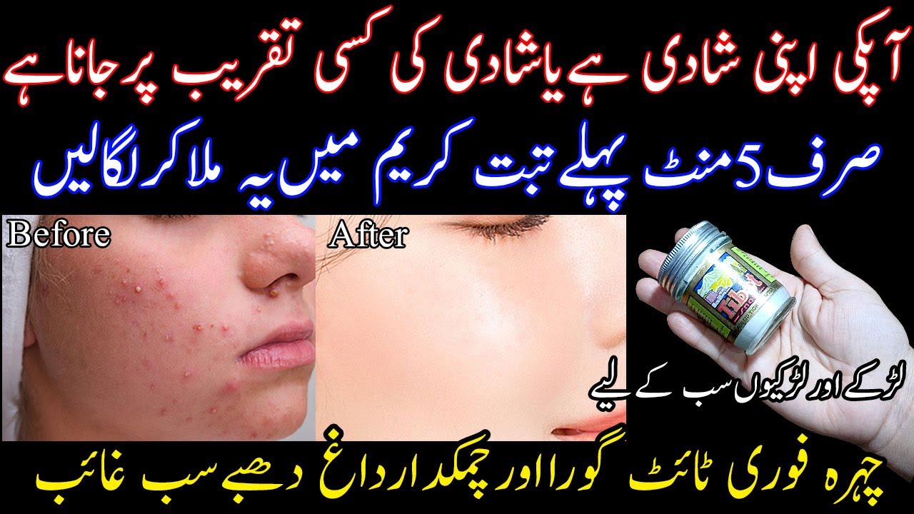 Just Mix This Magical Ingredient In Tibet Cream And Get Glass Skin ...