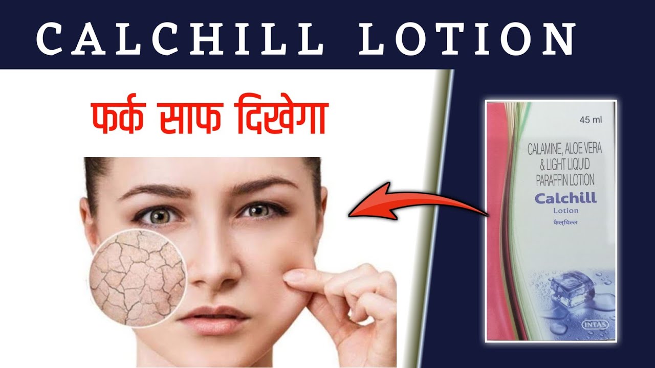 calchill lotion, calchill lotion uses, calchill lotion ke fayde ...