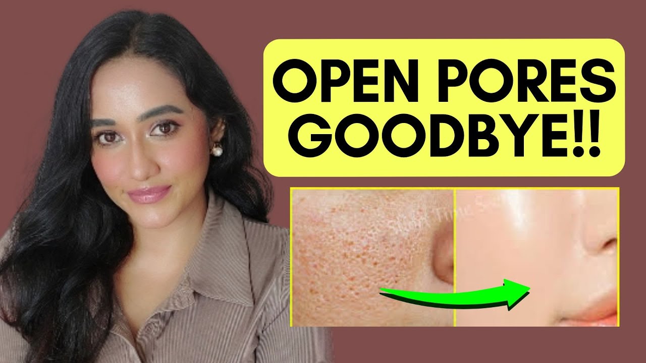 HOW TO TREAT OPEN PORES COMPLETELY. Open pores skincare routine, foods ...