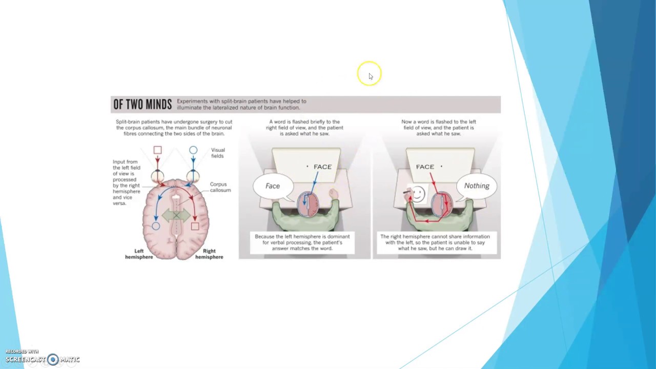 🎉 Split Brain Patients Split Brain Patients 2019 02 22