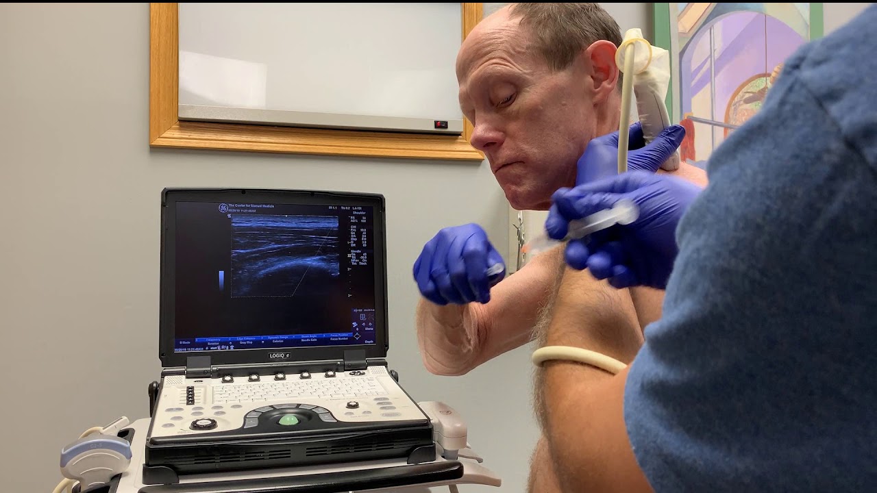 Scapula Pain Injection - YouTube