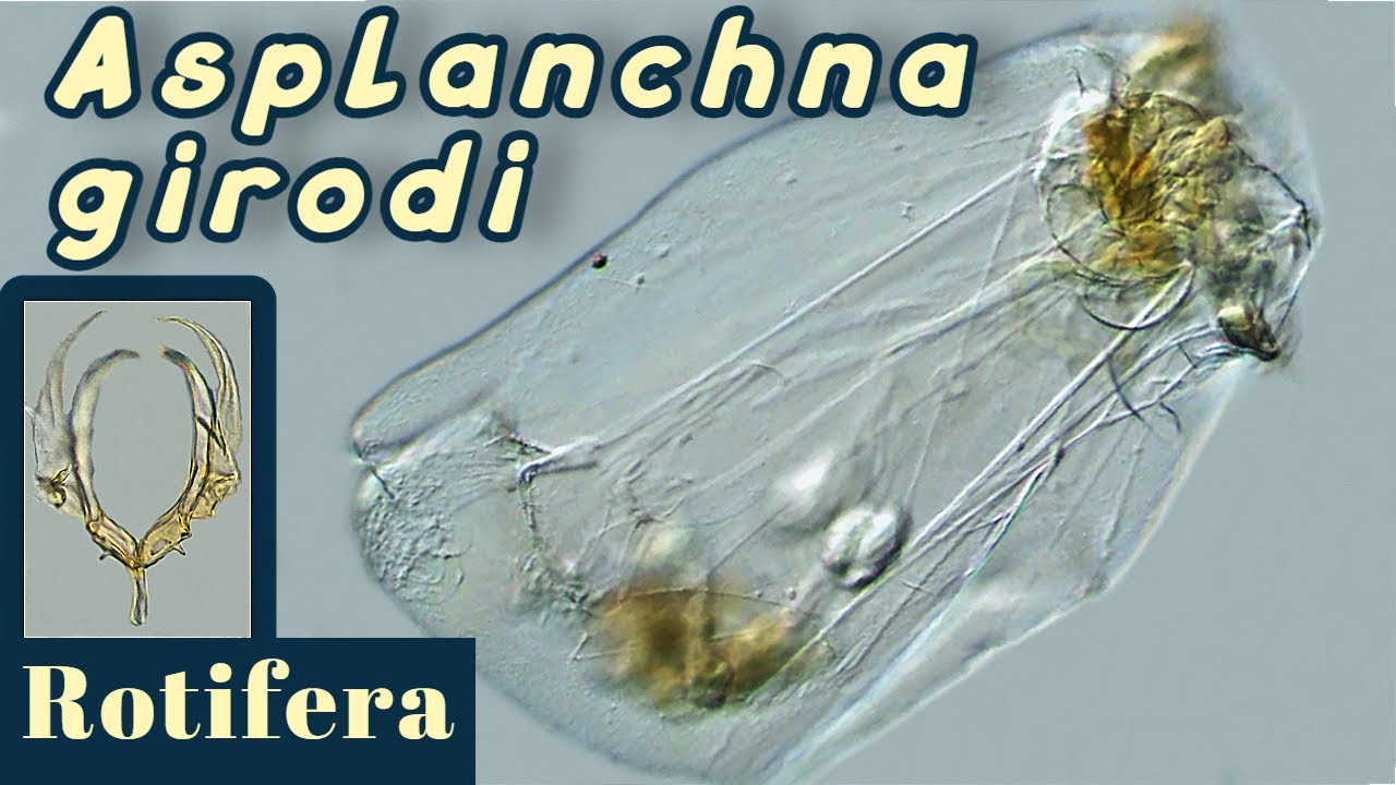 Large rotifer Asplanchna girodi (Wheel animal) - YouTube