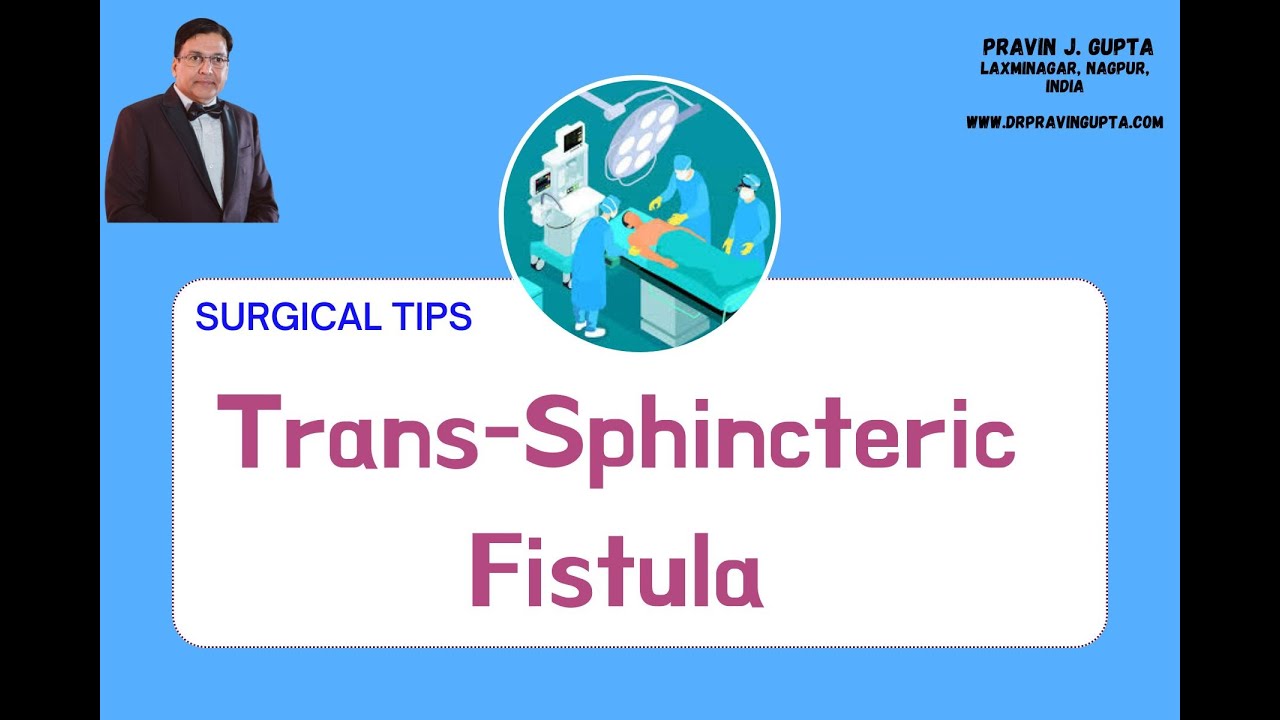 COMPLEX FISTULA REPAIR - YouTube