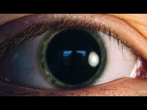 Os Olhos: O que seu formato, Pupilas e Retina falam de nossa percepção (Compreenção)de Vida?Sampako.