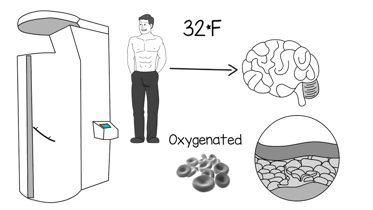 Cryotherapy Doodle Animation Video | Whiteboard Animation Video ...