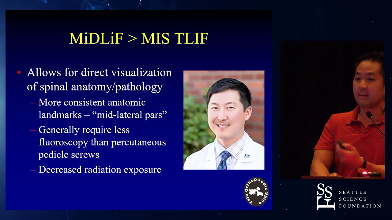 MiDLif for Lumbar Instability Mini Open TLIF using Cortical Screw ...