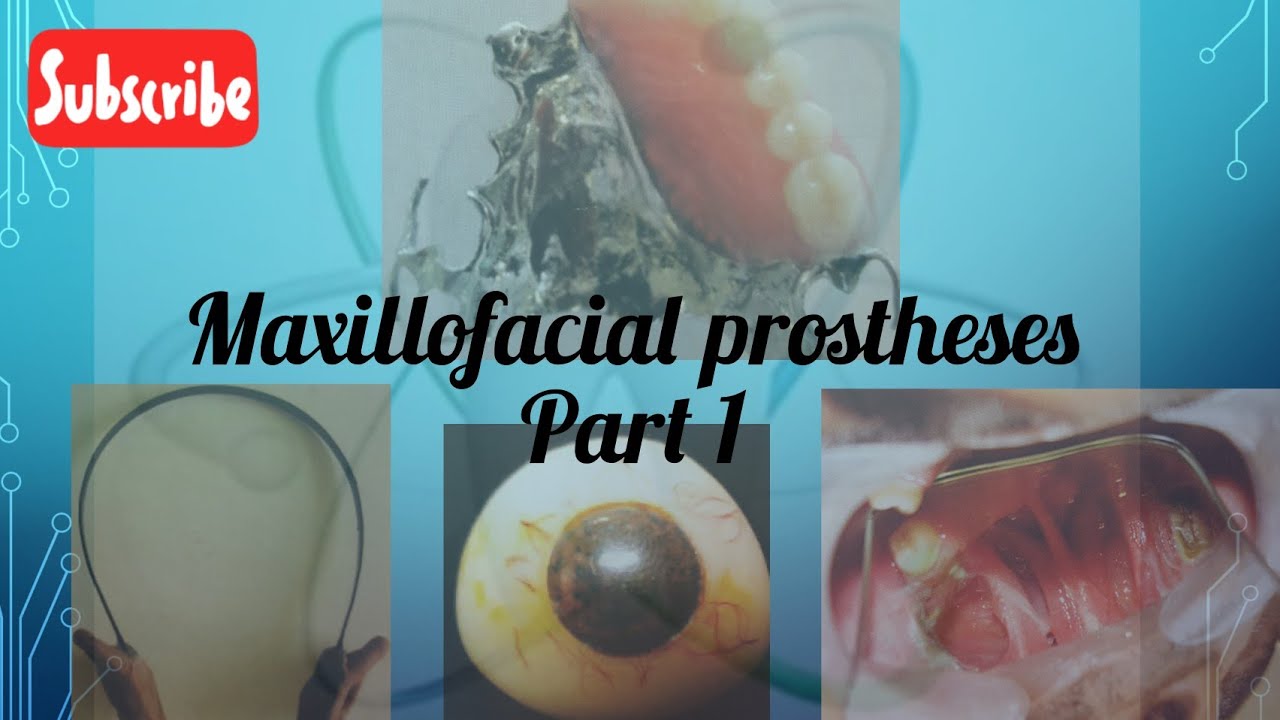 MAXILLOFACIAL PROSTHESES- PART 1 - YouTube