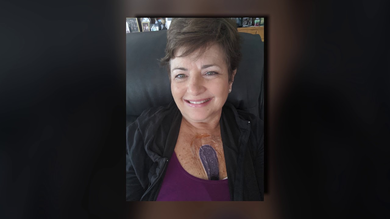 Boomer and Julie's Story: His and her surgery and recovery - Nebraska ...